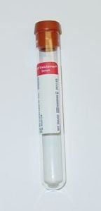 BD Vacutainer Blood Collection Serum Tubes | 366668, 367815, 366430 ...