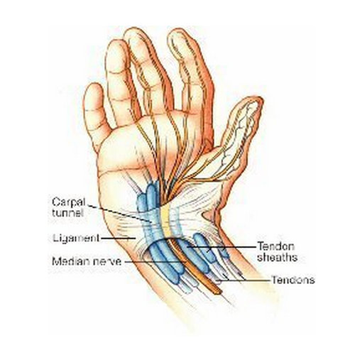 [Ships Free] CTRAC Carpal Tunnel Therapy Device - S/M/L | Vitality Medical