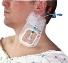 Centurion SorbaView Shield Dressing - Peripheral, Medium | Vitality Medical
