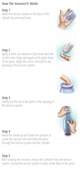 [Ships Free] Vacurect Vacuum ED Pump Device | Bonro Medical 1002