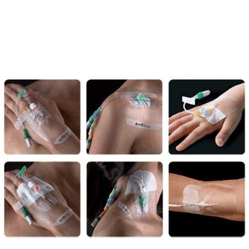 IV3000 Moisture Responsive Catheter Dressings - Peripheral, Central ...