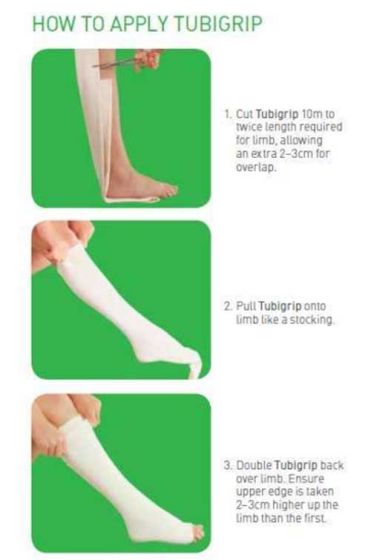 Tubigrip Elasticated Tubular Bandage - Molnlycke Healthcare | Vitality ...