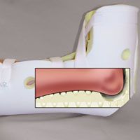 Posey Premium Heel Guard 6145 | Vitality Medical