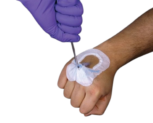 Centurion SorbaView Shield Dressing - Peripheral, Medium | Vitality Medical