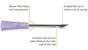 BD Nokor Filter and Admix Needles - 305201, 305200