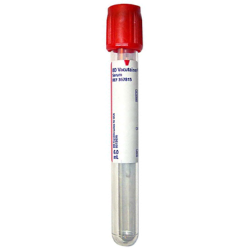 BD Vacutainer Blood Collection Serum Tubes | 367815, 366430, 367820 ...