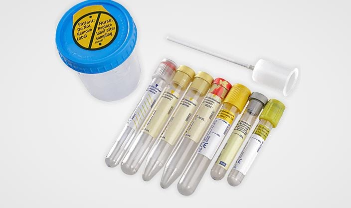BD Vacutainer Urine Collection System - 364979, 364954, 364957, 364966 ...