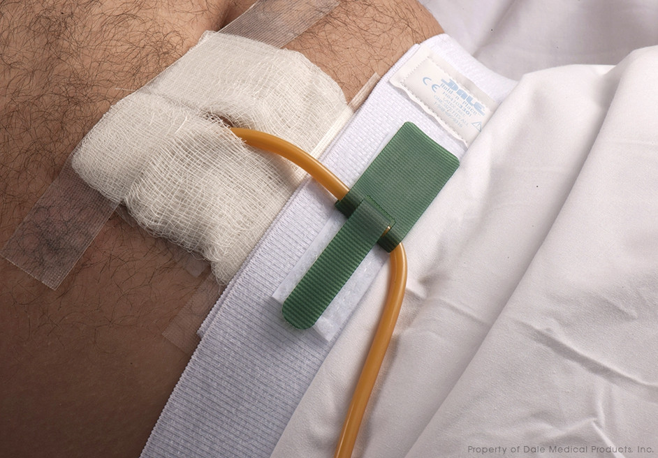 Dale Hold N Place Foley Catheter Holders Leg Band Waist Adhesive 316 330