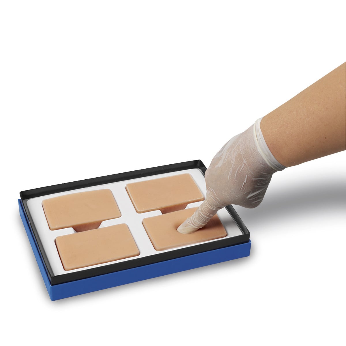 Nasco Life/form Pitting and Non-Pitting Edema Trainer | Vitality Medical