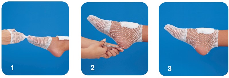 Stretch Net Tubular Elastic Bandage - Deroyal | Vitality Medical